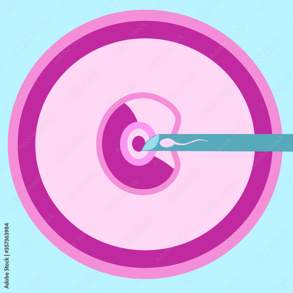 IVF, In vitro fertilization. Vector linear flat illustration. Baby boy ...