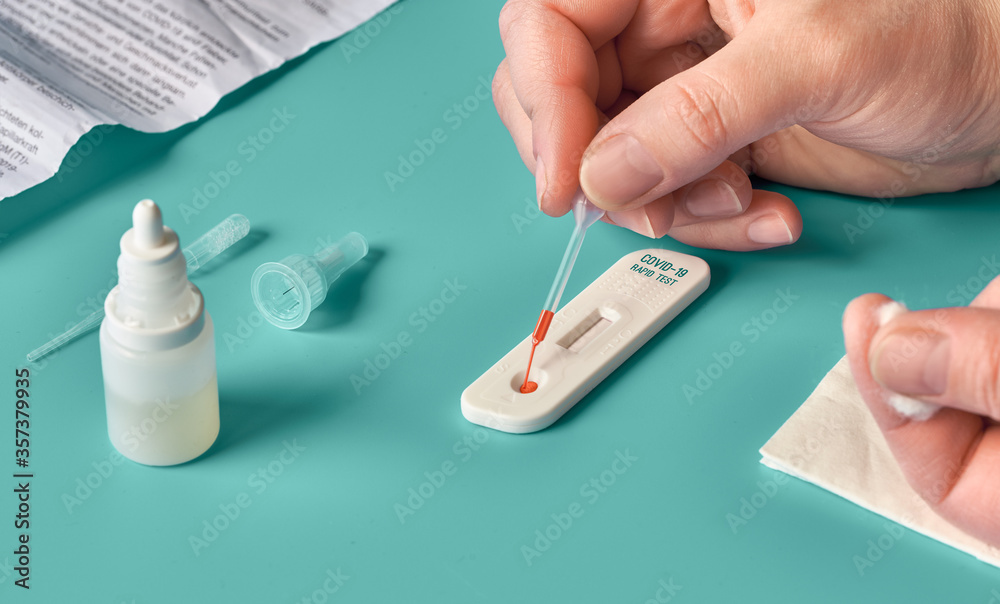 Rapid express COVID19 test for detection of specific antibodies to ...
