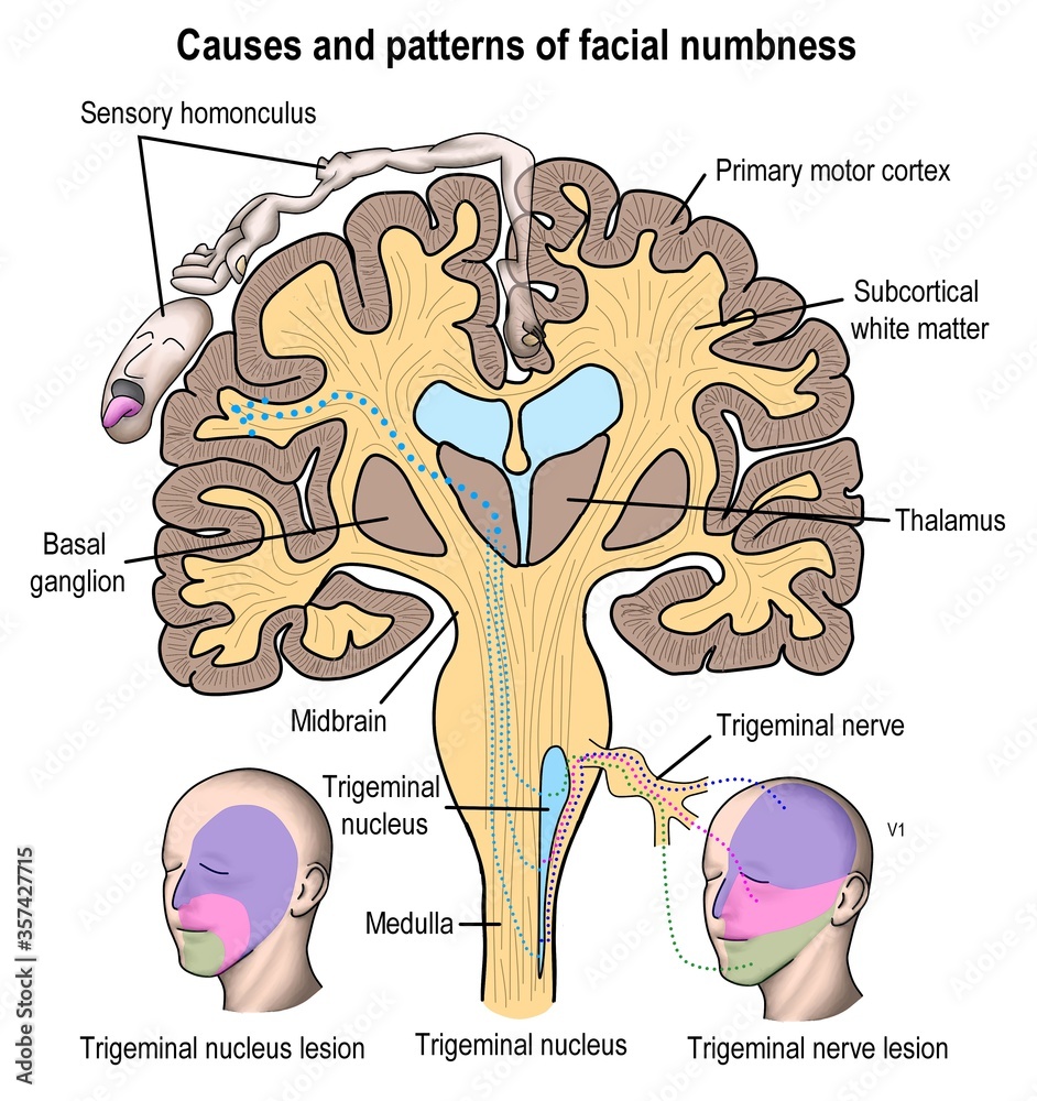 Facial Nerve Nucleus