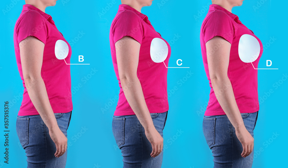 Collage with photos of woman demonstrating different implant sizes for ...