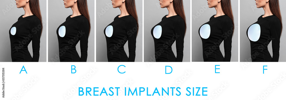 Collage With Photos Of Woman Demonstrating Different Implant Sizes For