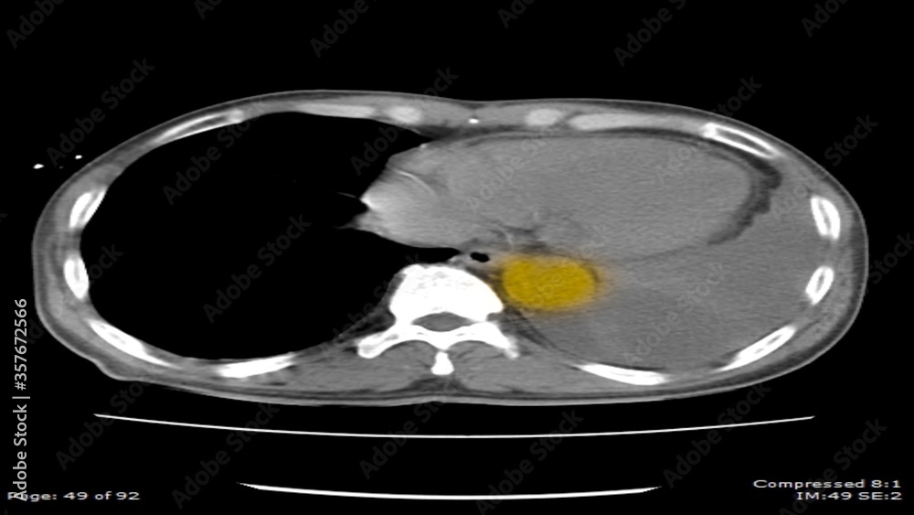 Abnormal Condition Of Yellow Medical Term at Joi Williams blog