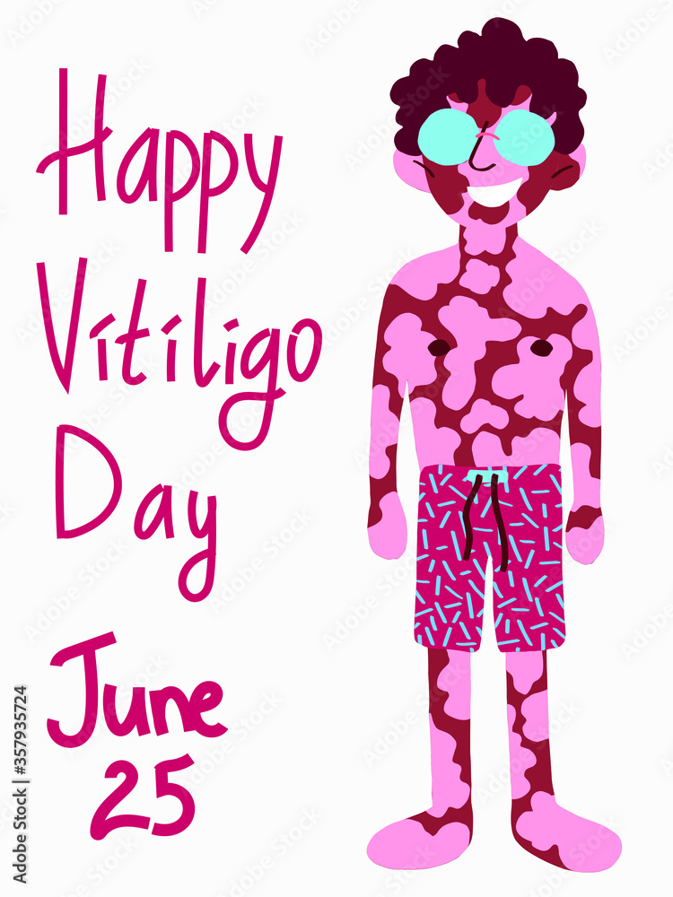 World vitiligo day stock vector illustration. Happy young man with ...