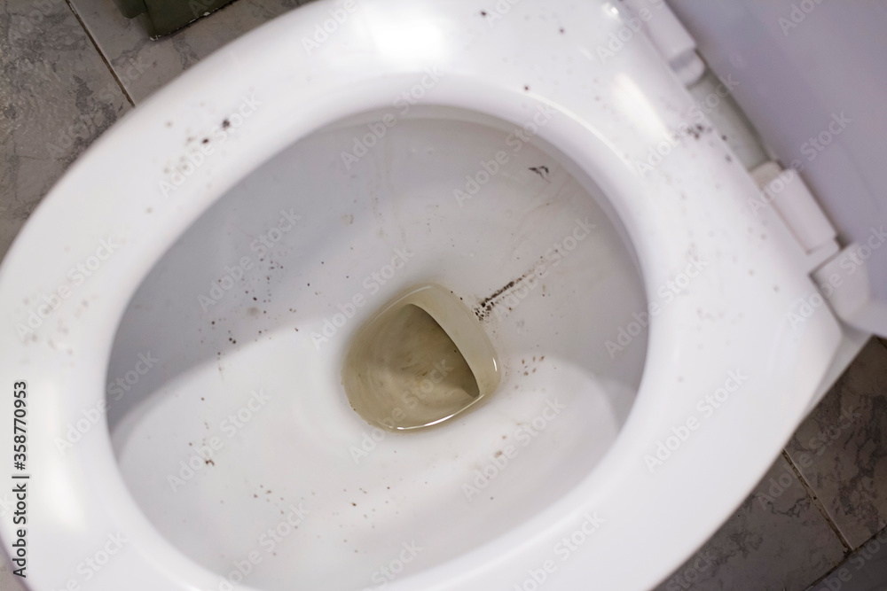Poster Very dirty and neglected toilet bowl – Wall Art | UkPosters