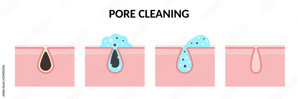 Vector Illustration Of Skin Care Steps Of Pore Cleaning Washing