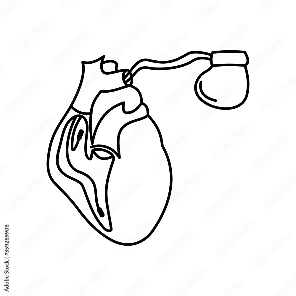 Vetor de Pacemaker, dual chamber pacemaker diagram icon. Heart ...