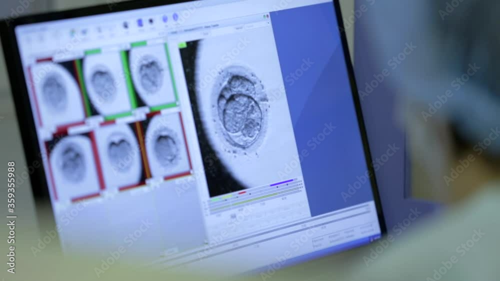 Medical Laboratory. On Monitor few Snapshots Germ of man. Artificial ...