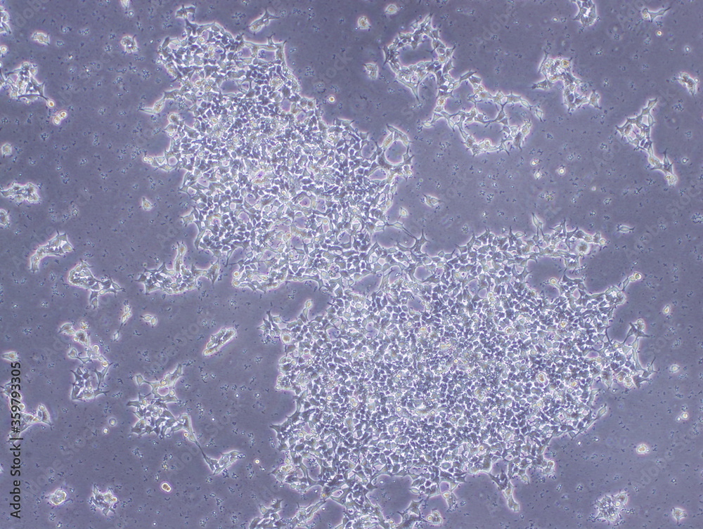 Human Brain Endothelial Cells (hCMEC/D3 cells) were captured by Light ...