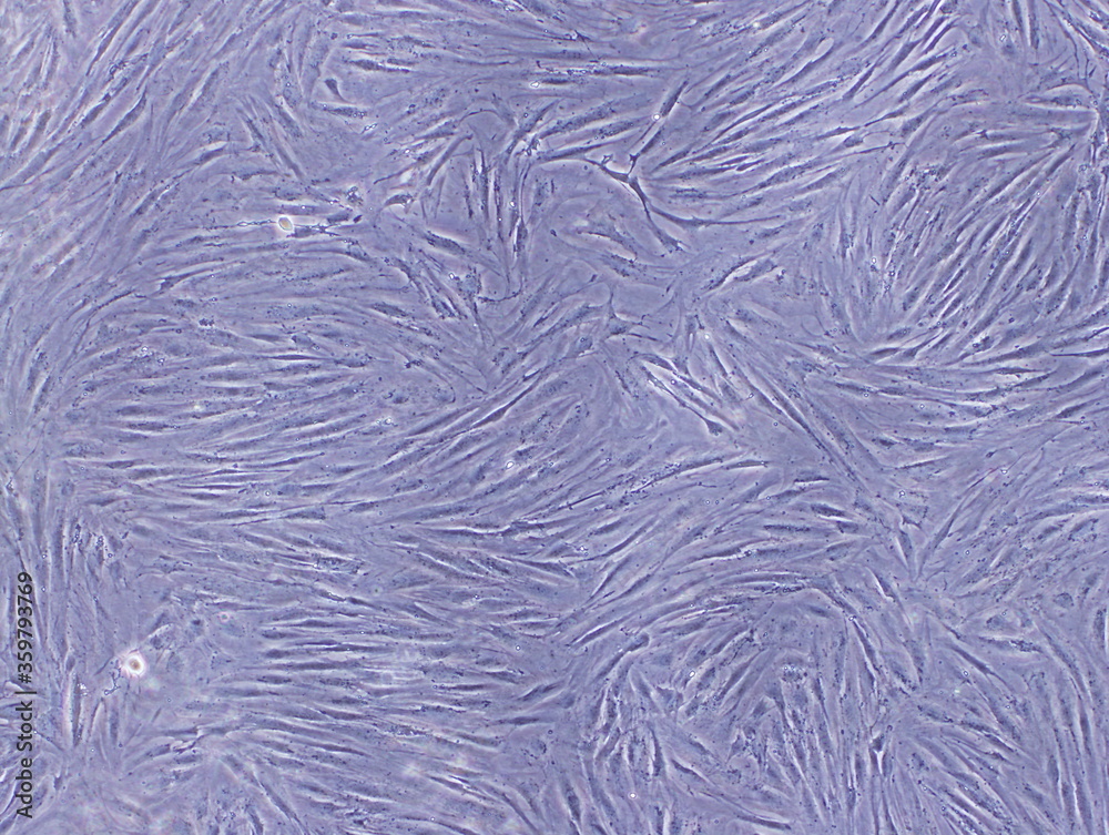 Fibroblasts ,the most common cells of connective tissue in animals ...