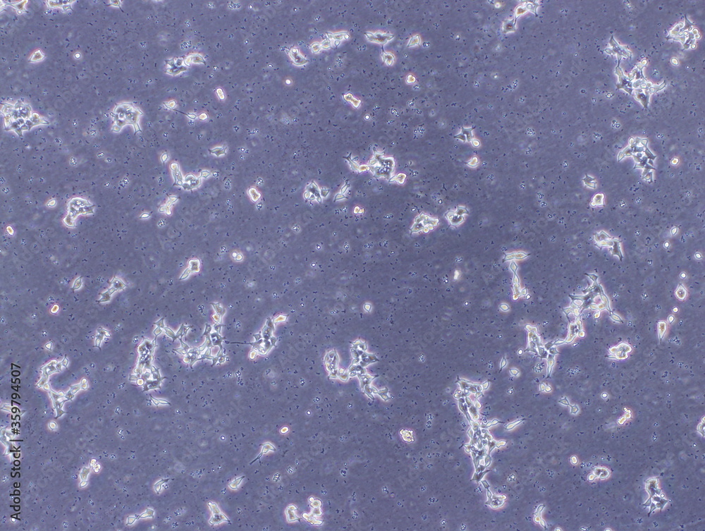 Human Brain Endothelial Cells (hCMEC/D3 cells) were captured by Light ...
