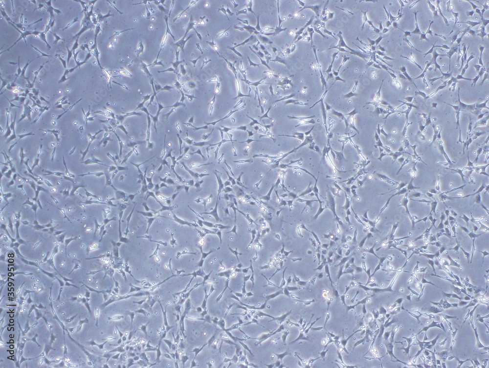 Human Brain Endothelial Cells (hCMEC/D3 cells) were captured by Light ...
