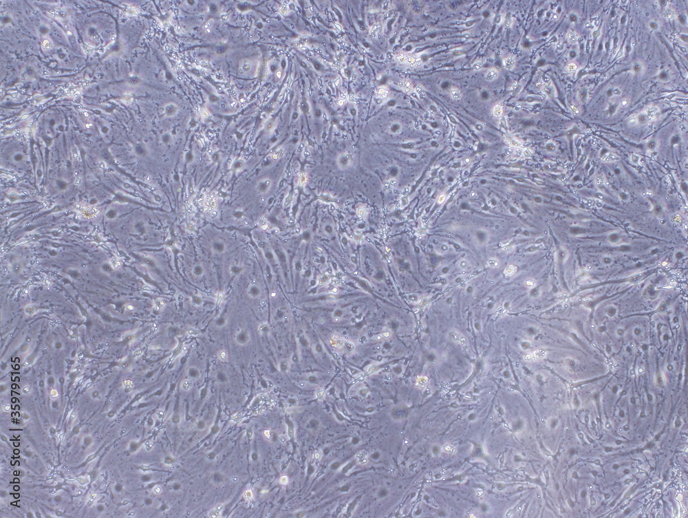 Mouse Cerebral Endothelial Cells (bEnd3 cells) were captured by Light ...