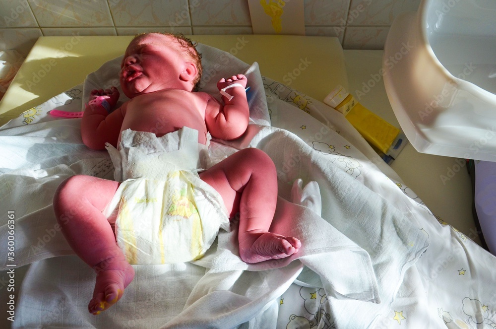 New born baby - girl with remainder of umbilical cord after successful ...