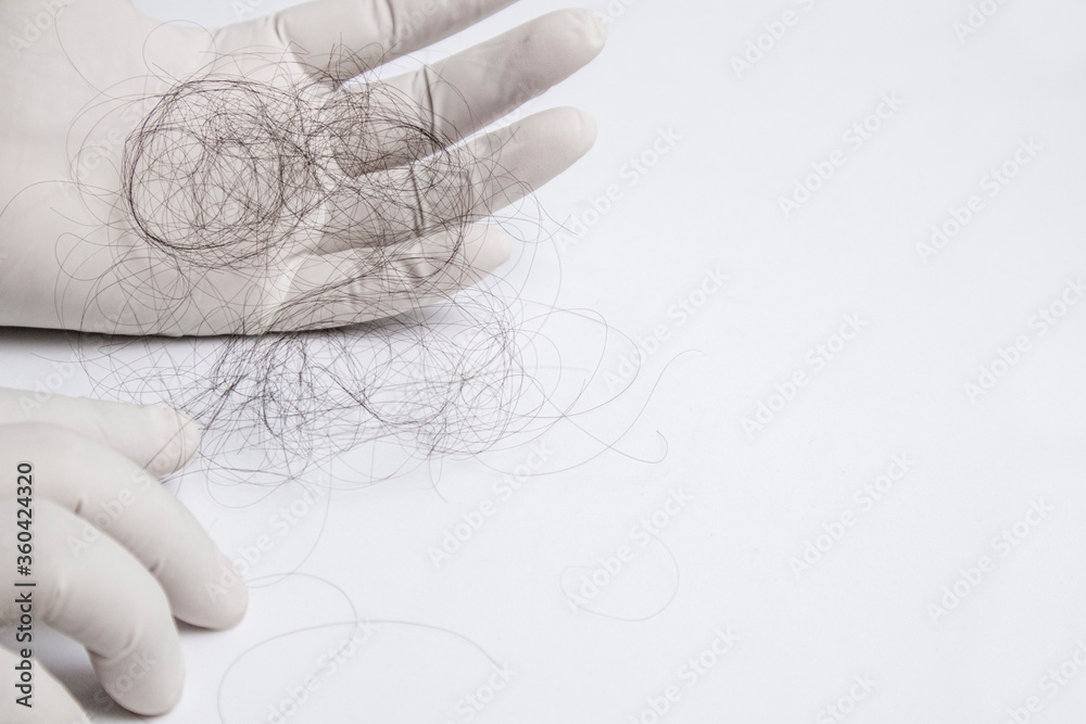 Hair experts wear gloves on both sides and pick up hair fall for check ...