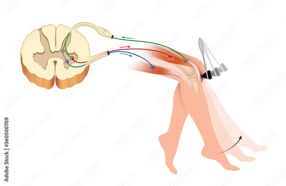 Knee Jerk Or Patella Tendon Reflex Stock Illustration Adobe Stock knee-jerk-or-patella-tendon-reflex-stock-illustration-adobe-stock