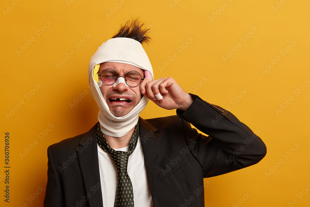 Displeased frustrated man cries and rubs eyes, has bruises and ...