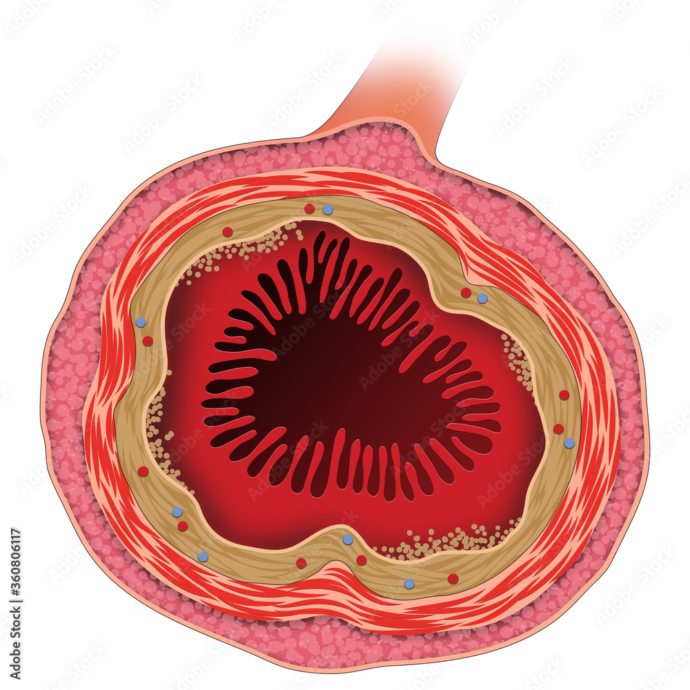 Structure of small intestine Stock Illustration | Adobe Stock