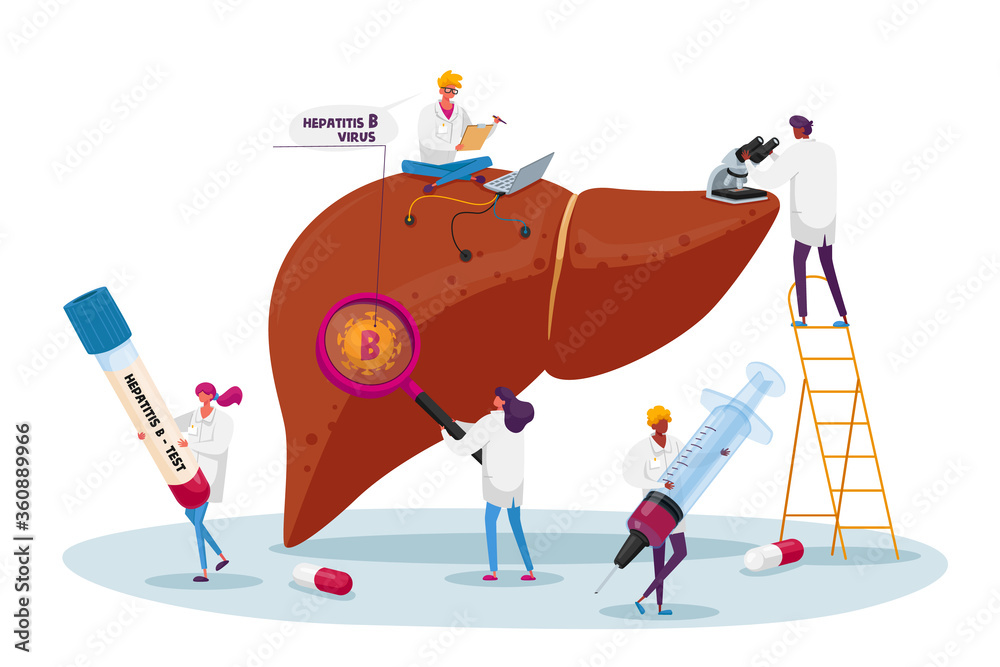 Medical Diagnosis Hepatitis B World Day, Cirrhosis Concept, Tiny Doctor ...