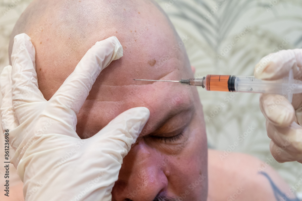 men's cosmetic operations. injections in the forehead to straighten out ...