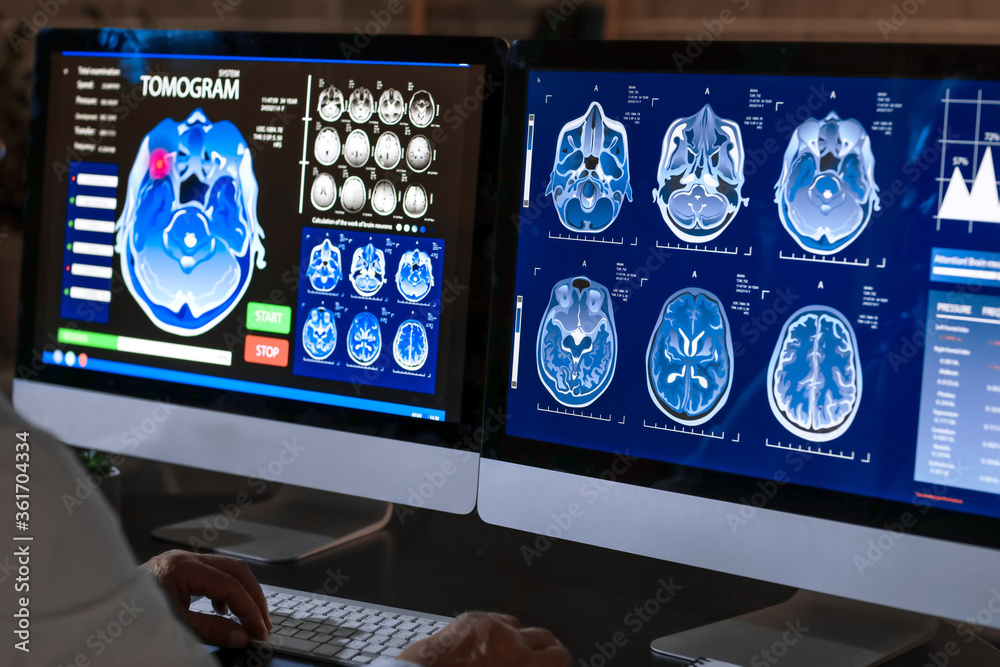 Male neurologist with MRI scan of human head on screen of computer ...