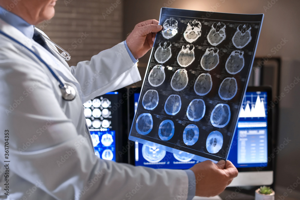 Senior neurologist with MRI scan of human head in clinic Stock Photo ...
