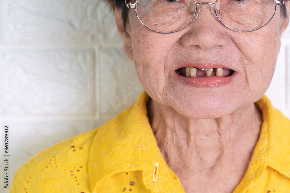 Asian Elderly woman over 70 years old be smile with a few broken teeth ...