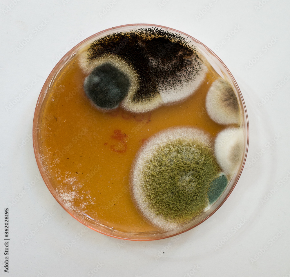 bacteria and fungi growth on plate contain agar media Stock Photo ...