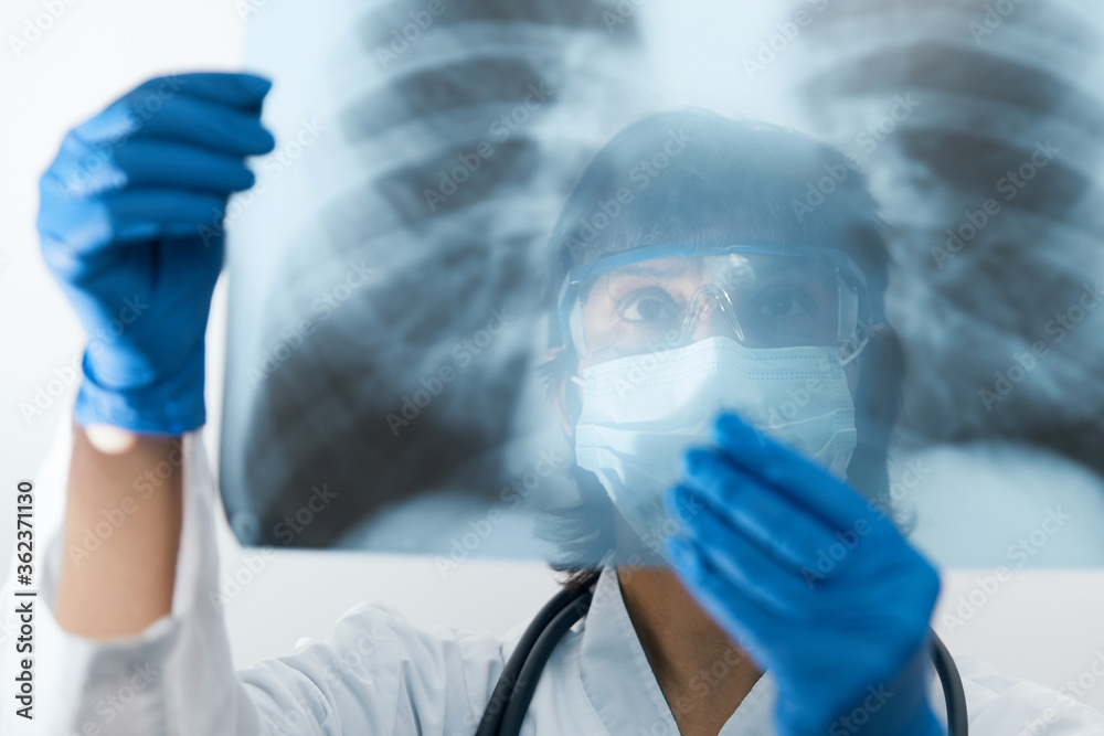 Medical doctor looking through x-ray picture of lungs for viral ...