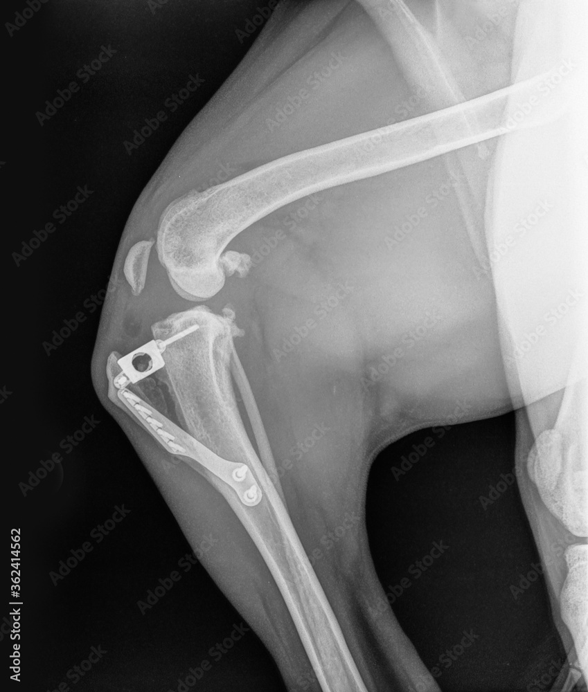 Digital X-ray of a knee of a dog after Tibial Tuberosity Advancement or ...