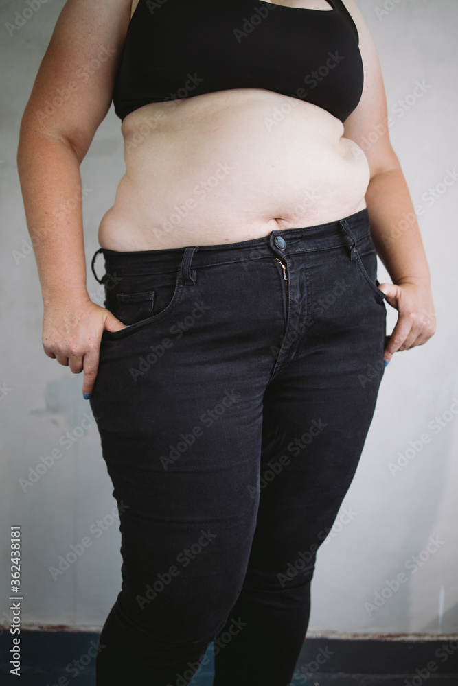 Overweight woman with obese body over studio background. Weight loss ...