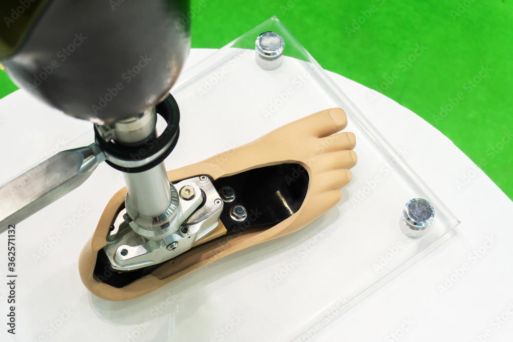 Bionic foot. Layout of a prosthetic leg. View from above. Stock Photo ...
