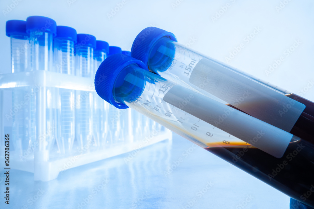 Test tubes with blood close up. Place for inscription on test tubes ...