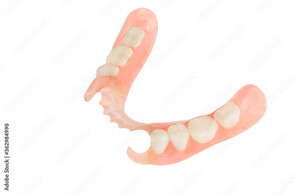 Removable plastic partial denture on white background Stock Photo ...