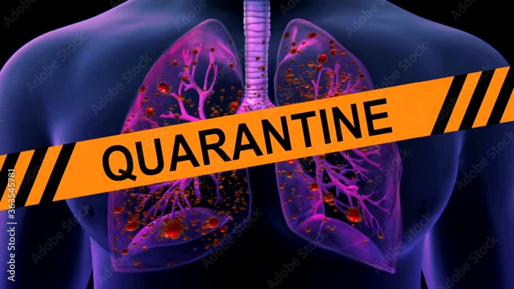 Realistic 3D footage animation of the severe acute respiratory syndrome ...