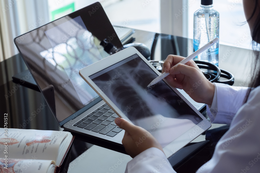 Doctor woman hand holding digital tablet with chest x-ray film (CXR ...
