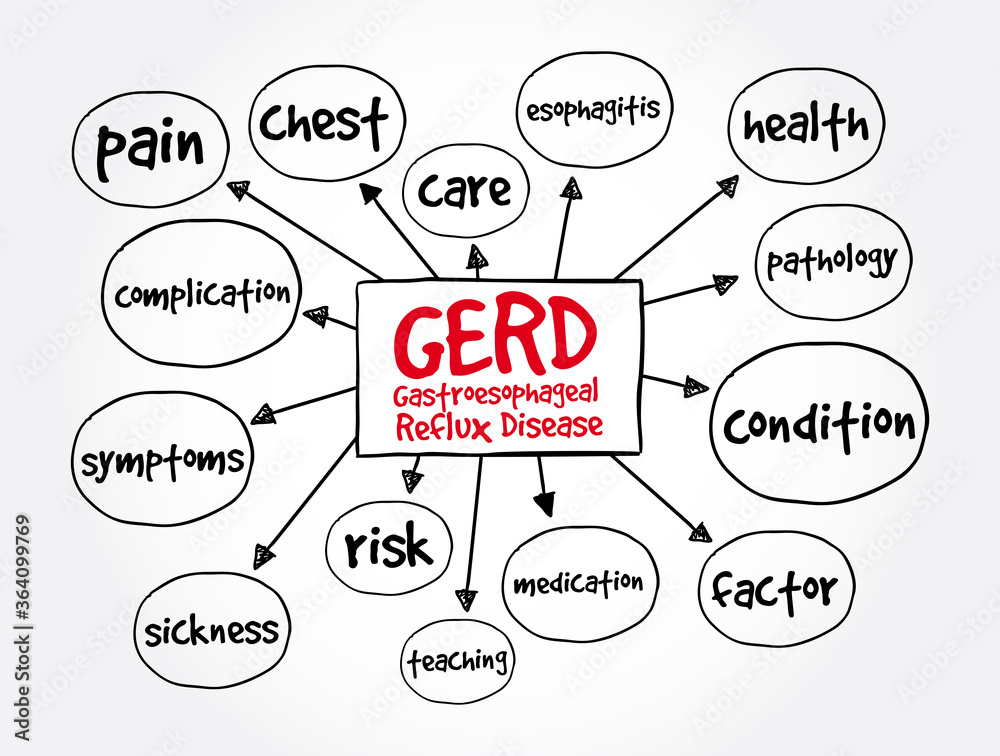 GERD - Gastroesophageal Reflux Disease mind map, medical concept for ...
