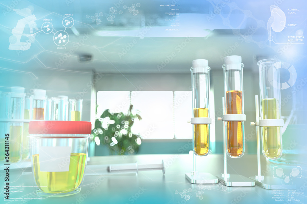 test-tubes in modern microbiology college facility - urine quality test ...