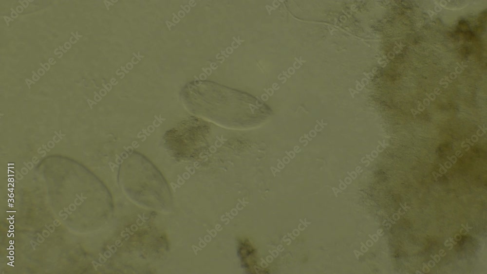 Microscopy of protozoa microorganisms in the water, showing ciliates ...