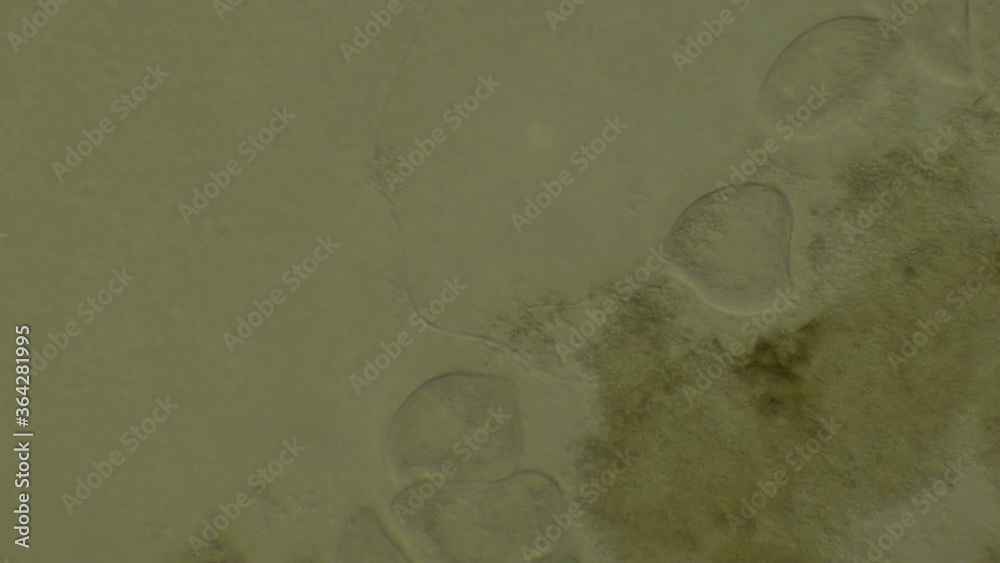 Microscopy of protozoa microorganisms in the water, showing ciliates ...