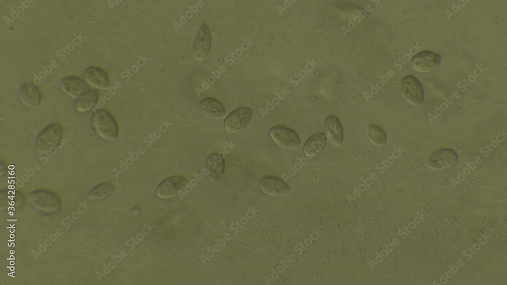 Microscopy of protozoa microorganisms in the water, showing ciliates ...