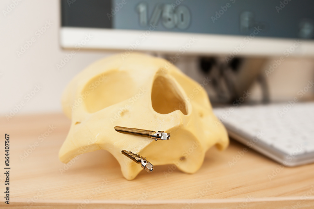 mock-up of a human skull, demonstration of dental prosthetics on ...