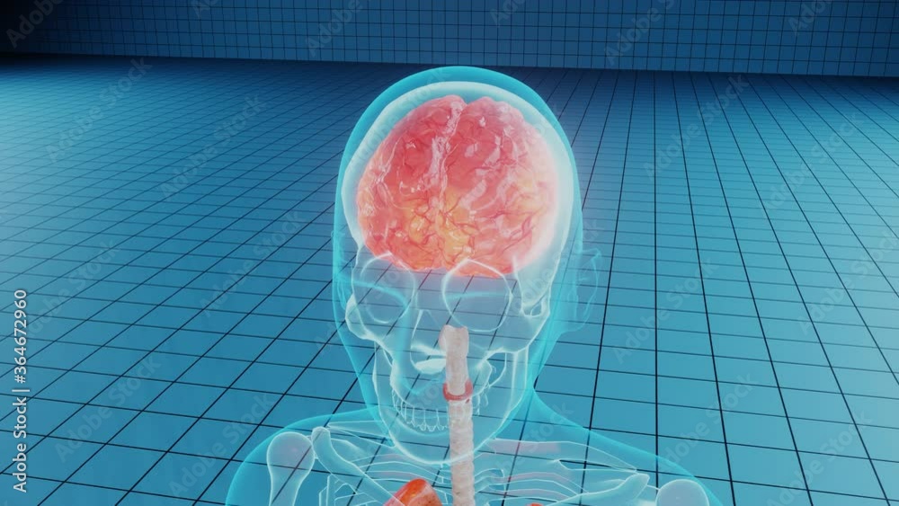 3D render animation of Brain damage in human body. Medical science MRI ...