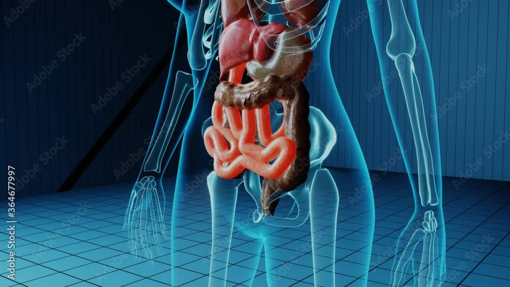 Damaged failed small intestine in human body. 3D render animation of ...