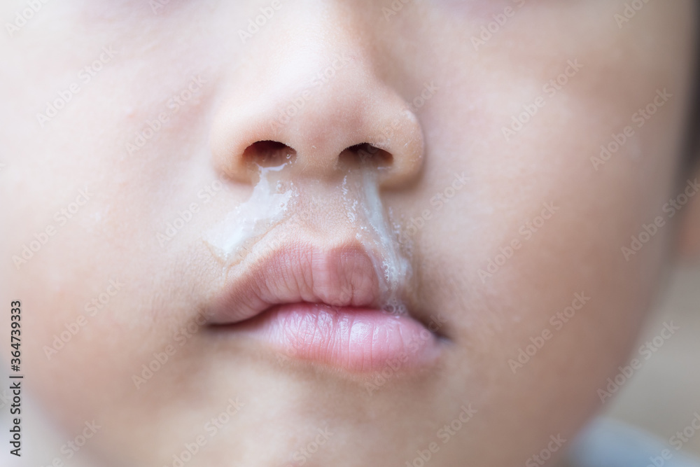 Closeup of Asian little boy have fever and runny nose Stock Photo ...