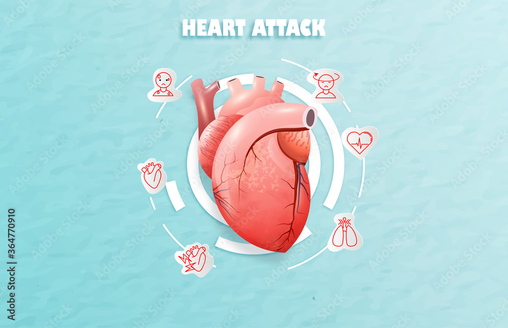 Heart attack, sign, and symptom of the disease. A concept hospital for ...