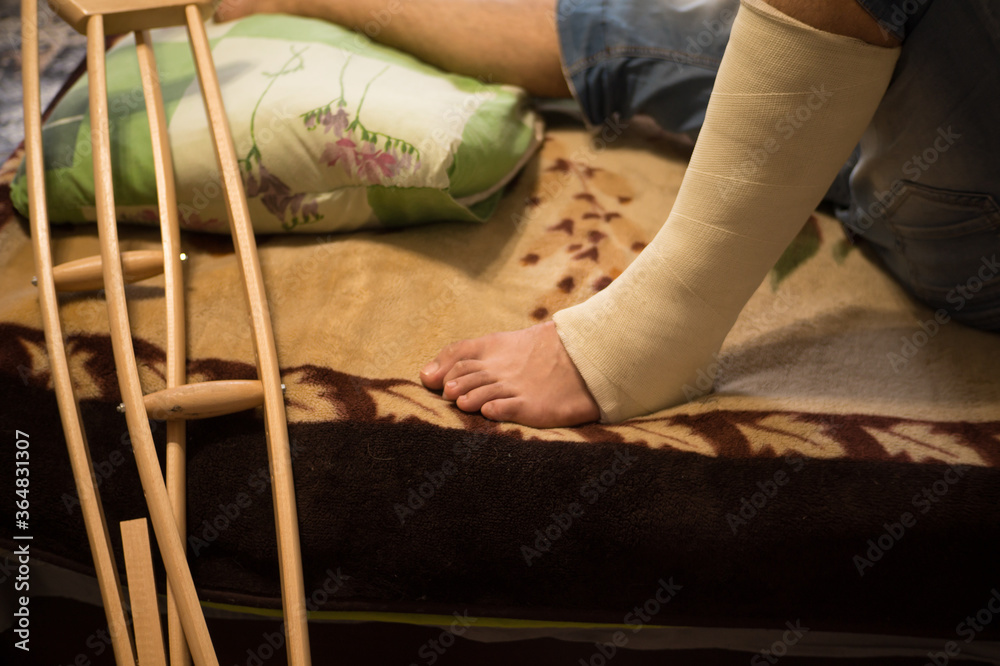Gypsum is imposed on the man’s leg and walking on crutches is ...