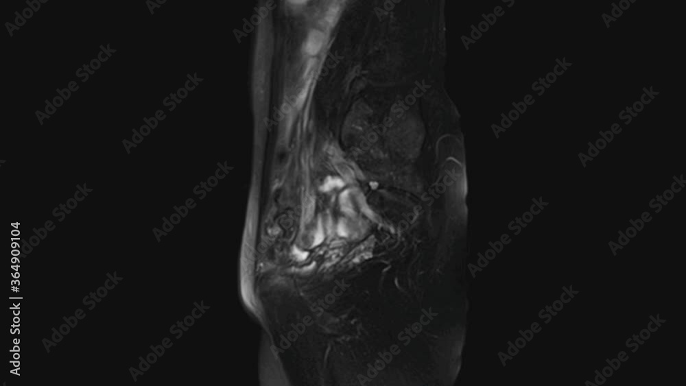 MRI of the female pelvic organs, abdominal cavity, gastrointestinal ...