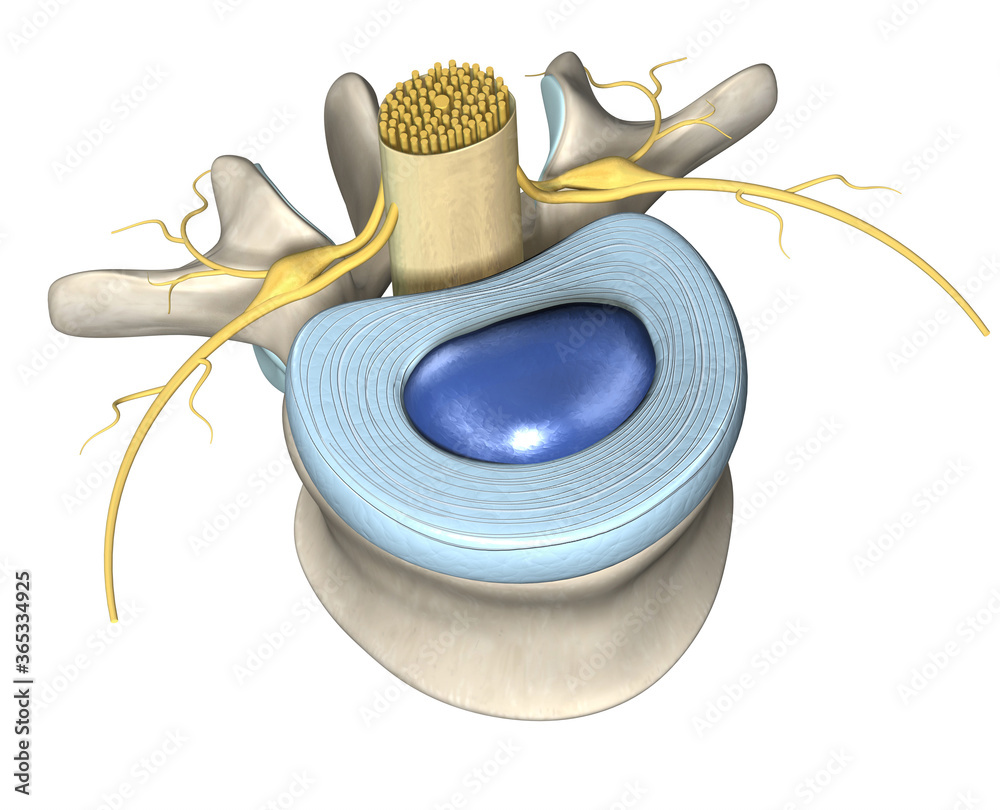 Lumbar vertebra with intervertebral disc, medically 3D illustration ...
