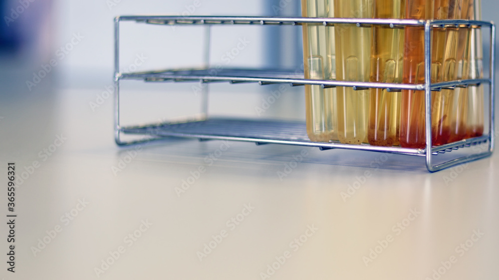 Microbiology analysis E.Coli in food sample use Most Probable number ...