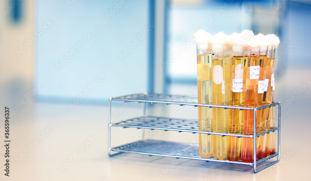 Microbiology analysis E.Coli in food sample use Most Probable number ...